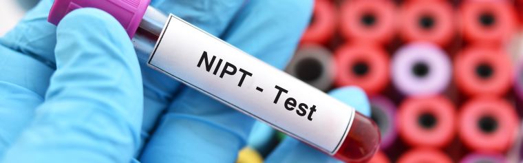 Ethical questions of pregnancy management following a positive NIPT/PND ...